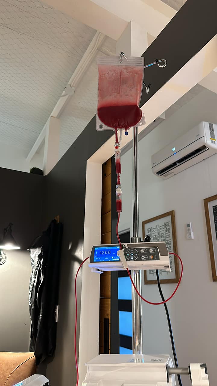 Ozone with UBI | R&R Aesthetics + Wellness Fort Worth, TX